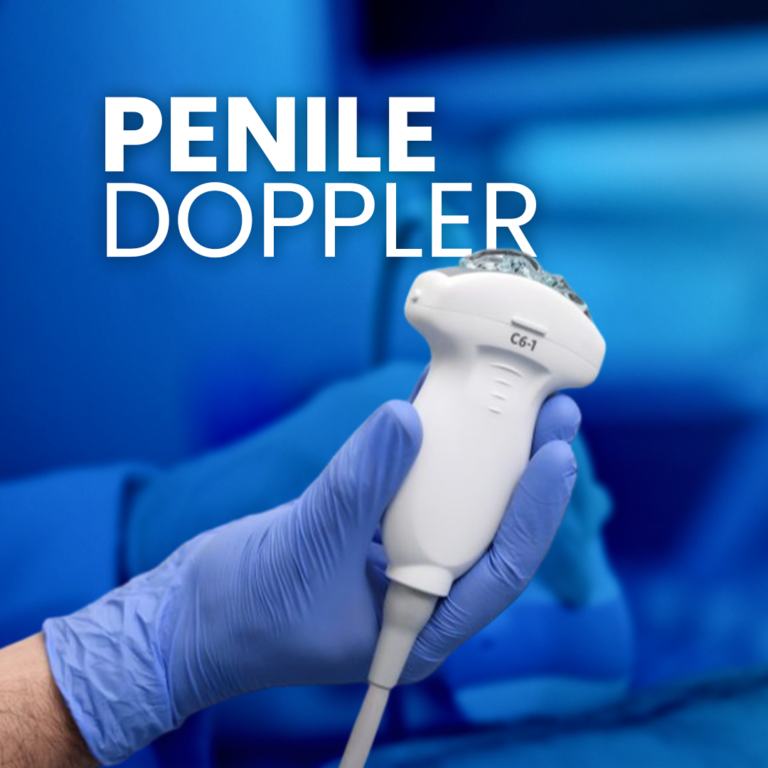 Penile Doppler Test in Delhi - Govinda Lifecare