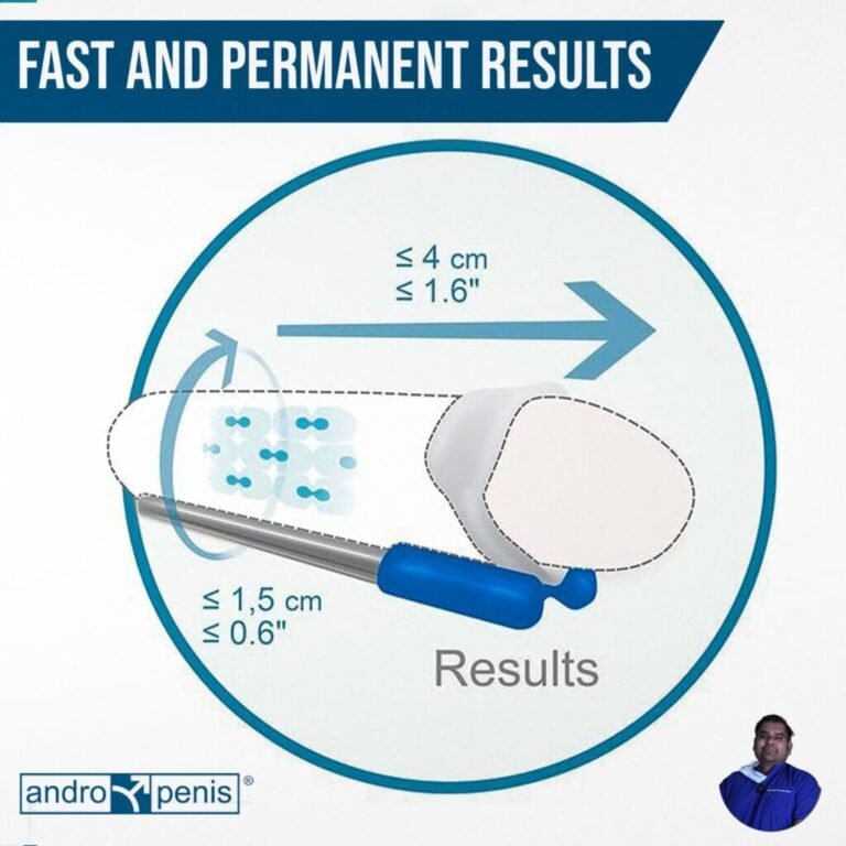 Andropenis Pro - Penile Enlargement Device